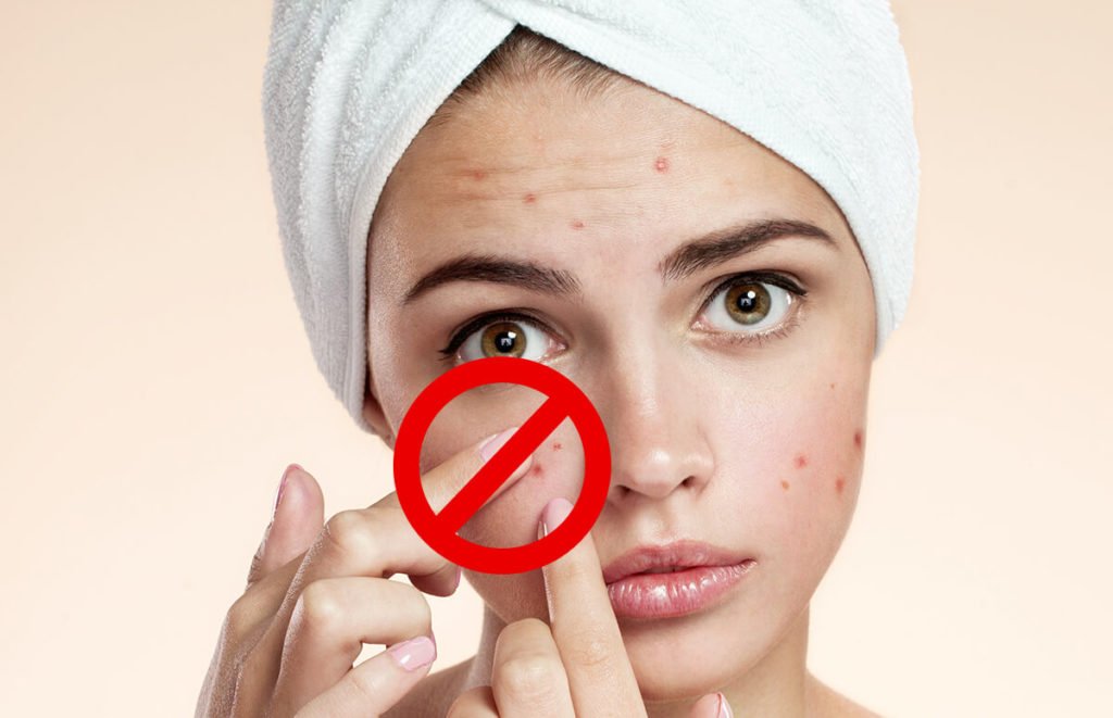 Top 5 Tips to Have a Pimple-Free Face | For Men and Women - HopyTapy