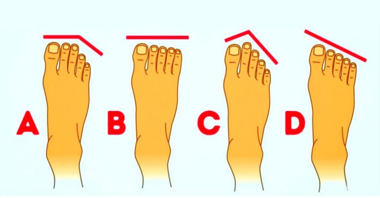 These 7 Shapes of Foot Reveal Individual’s True Personality | Pay ...